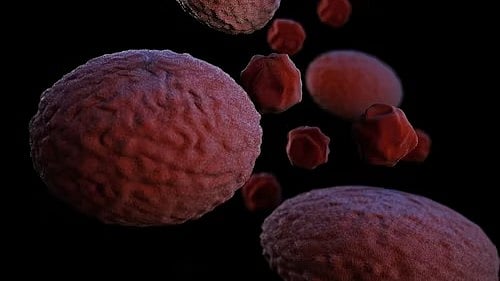 Rare Bacterial Meningococcal Disease Surges in the US
