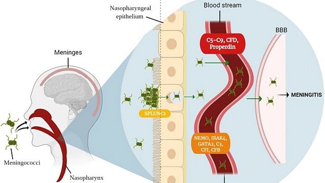 Rare Bacterial Meningococcal Disease Surges in the US