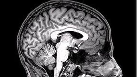 World’s Most Powerful MRI Scanner Reveals its First Images of Human Brain
