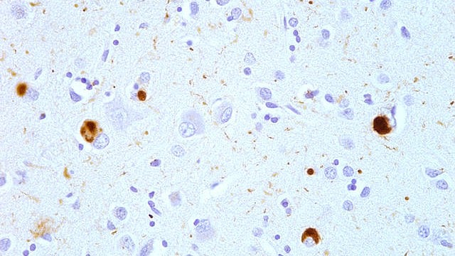 Scientists Identify Cells Vulnerability ‘Fingerprint’ Related To ...