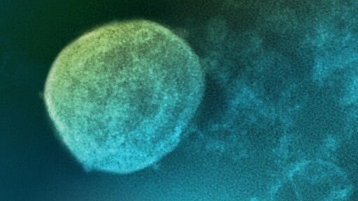 Male Nurse In Coma Requires Advance Treatment After Treating a Nipah ...