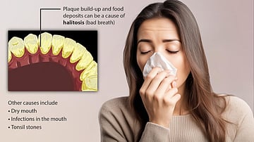 Everything You Need to Know About Teeth Scaling: A Dentist’s Perspective