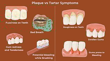 Everything You Need to Know About Teeth Scaling: A Dentist’s Perspective