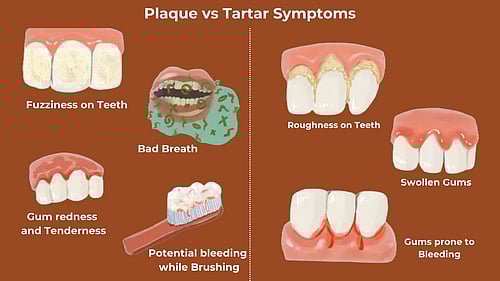 Everything You Need to Know About Teeth Scaling: A Dentist’s Perspective