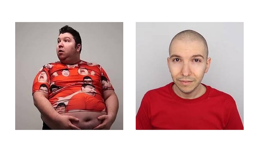 Nikocado Avocado’s 250-Pound Weight Loss Stuns Fans After Two Years of ...