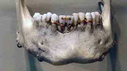 Exploring Tooth Ablation in Prehistoric Taiwan: Cultural Practices and ...