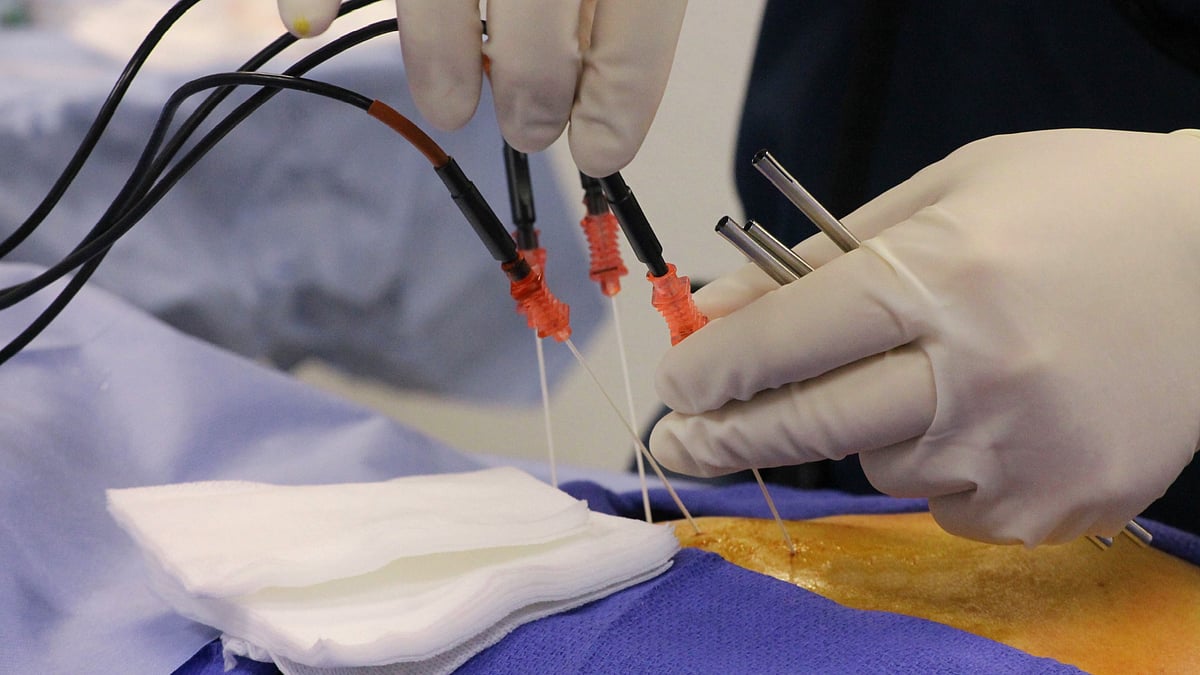 Malaysia: Woman Awarded RM 1.1 Million After Botched Surgery Leaves Her ...