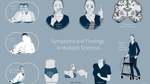 ACTRIMS Outlines Guidance for Diagnosing Pediatric and Late Onset ...