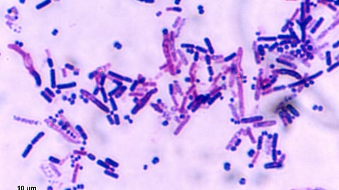 Scrub Typhus in India: The Re-Emerging Threat of a Forgotten Zoonosis