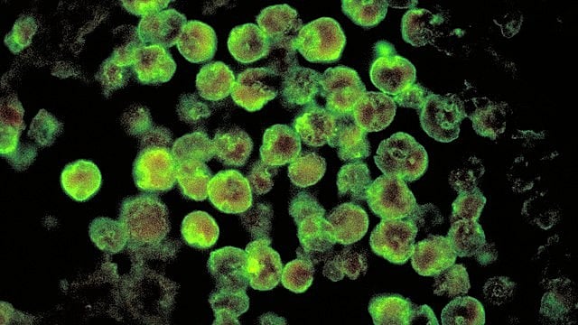 10-Year-Old from Kerala Diagnosed with Rare Brain Infection, Primary ...