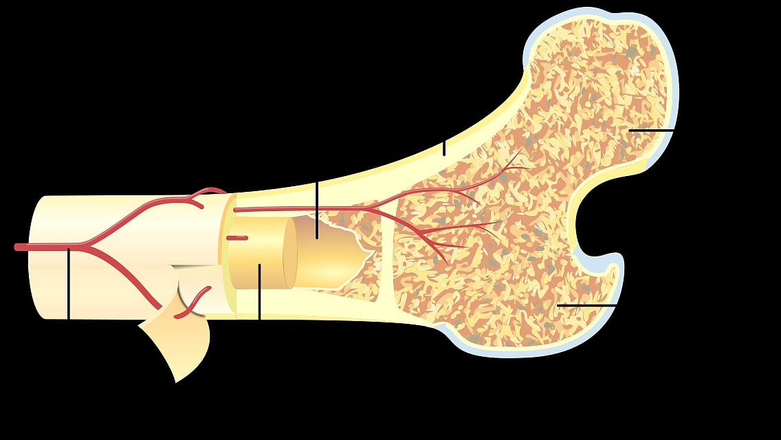 Kolkata Hospital Achieves Success with Complex Half-Matched Bone Marrow ...