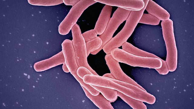 New Guidelines for Drug-Susceptible and Drug-Resistant TB: Shorter ...