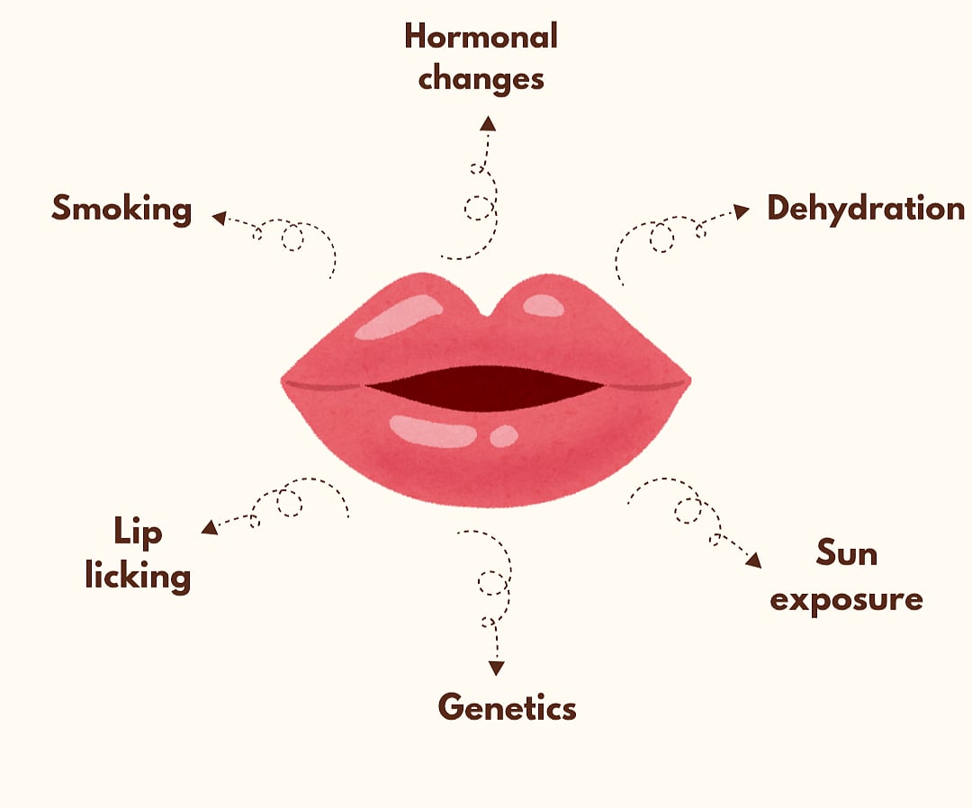 Lip Pigmentation: Not Just Due to Smoking