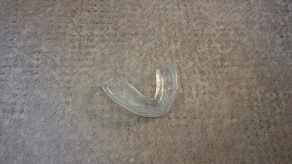 Tooth Wear:Attrition Vs Abrasion