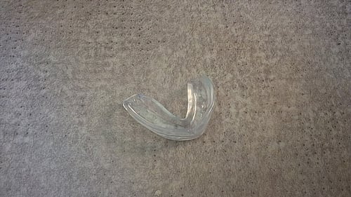 Tooth Wear:Attrition Vs Abrasion