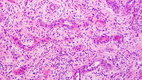 Why Some Wounds Heal Faster Than Others: Wound Healing guide