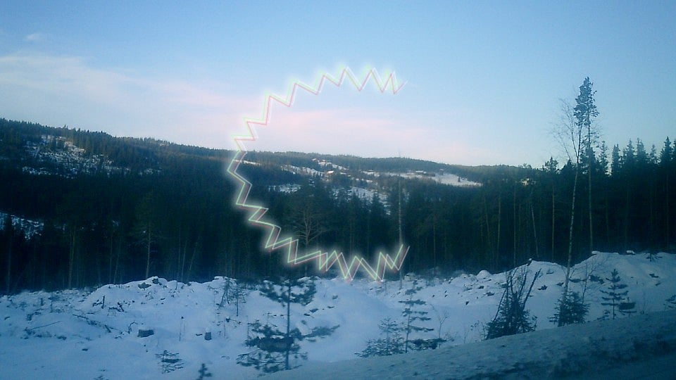 Visual Auras and Cardiovascular Procedures: A link to Brain Lesions