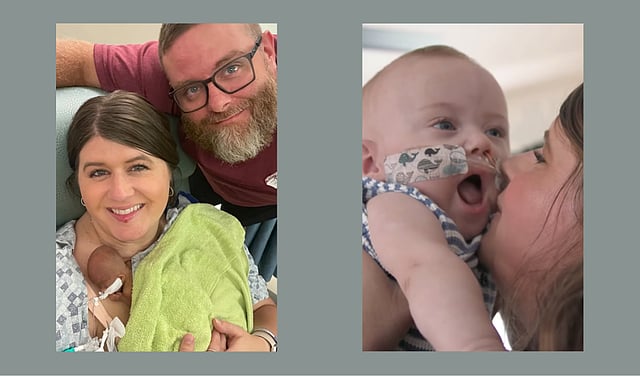 World's Most Premature Baby Nash Keen Defies Odds to Turn One