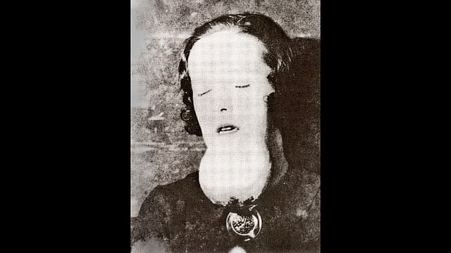 Radium Girls: How Their Fight Transformed Workplace Safety