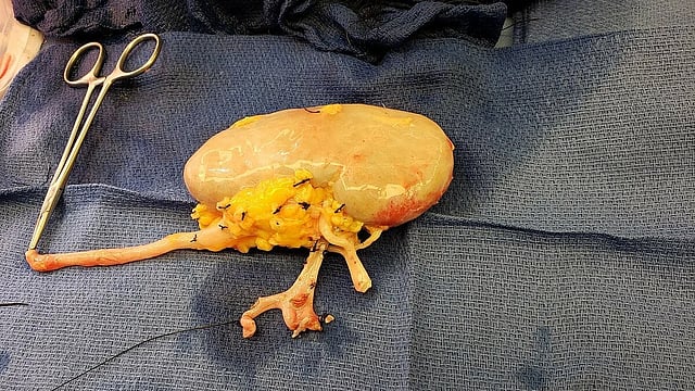 FDA Clears Clinical Trials for Gene-Edited Pig Kidney Transplants