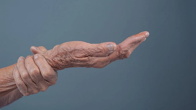 Eponymous Diseases: 5 Famous Conditions Named After People