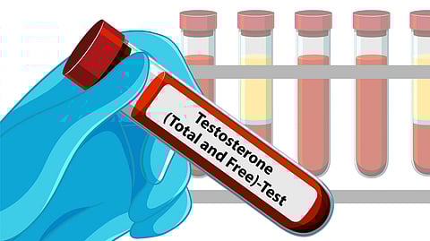 Sex Hormones and Heart Disease Risk in Type 2 Diabetes