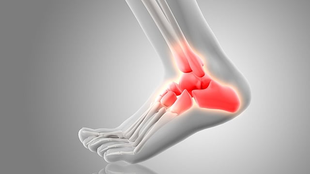 Right Shoes for Plantar Fasciitis: Reduce Heel Pain Naturally