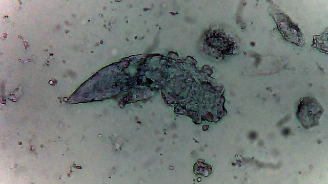 Demodex Mites: Understanding the Tiny Creatures Living on Your Skin