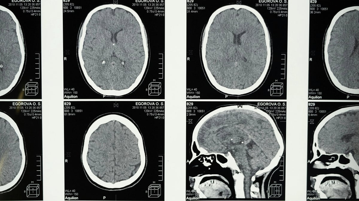 How Brain-Computer Interfaces Help Neurological Patients