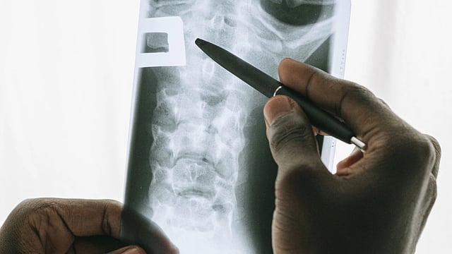 Spinal Cord Injury Costs: Understanding Lifetime Medical Expenses