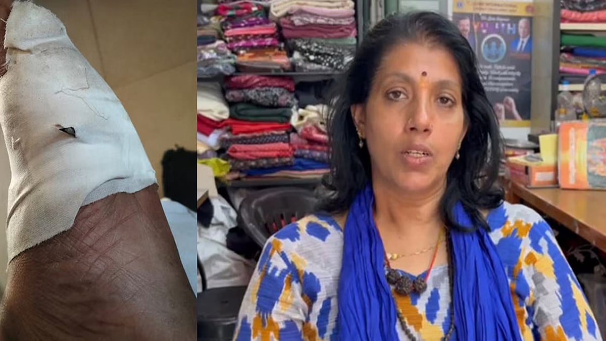 Wound bandaged with surgical blade inside at Pamba govt hospital, pilgrim