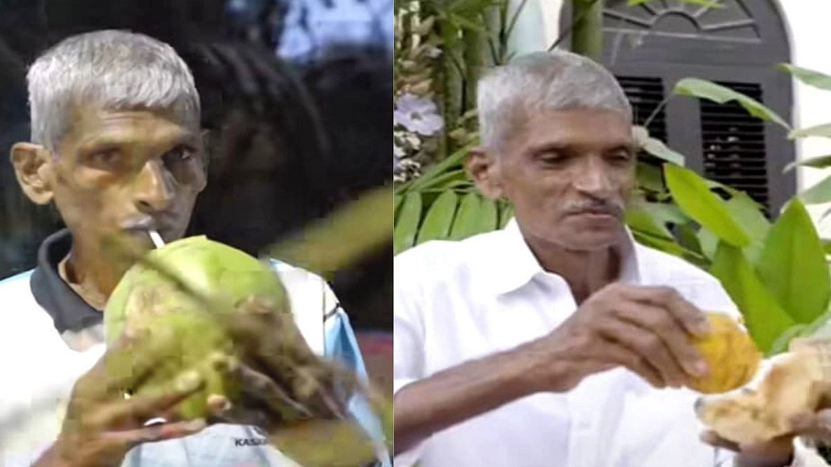 The coconut man of India who routs GERD through a coconut diet!
