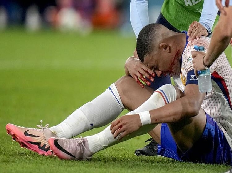 Kylian Mbappé due for tests on his broken nose as France gets ...