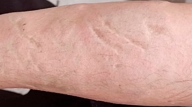 “Adiós, guapa” le gritan a mujer y le lanzan ácido, en Puebla