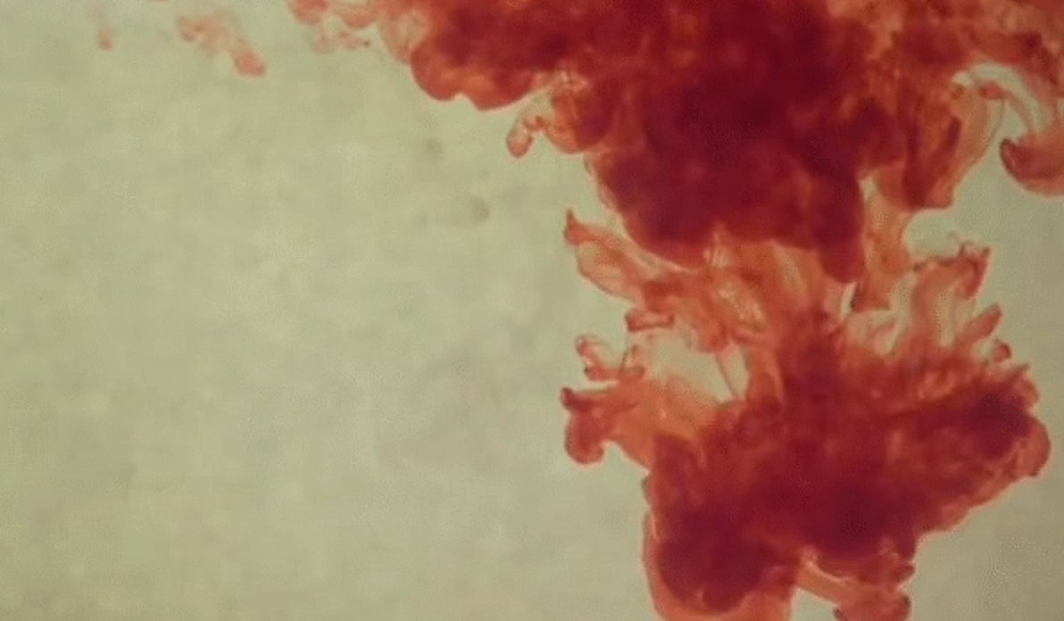 En este país te podrán dar compensaciones por sangre infectada