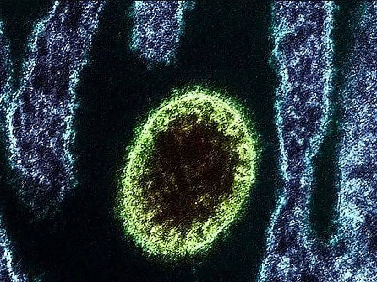 What is this new Langya virus? Do we need to be worried?