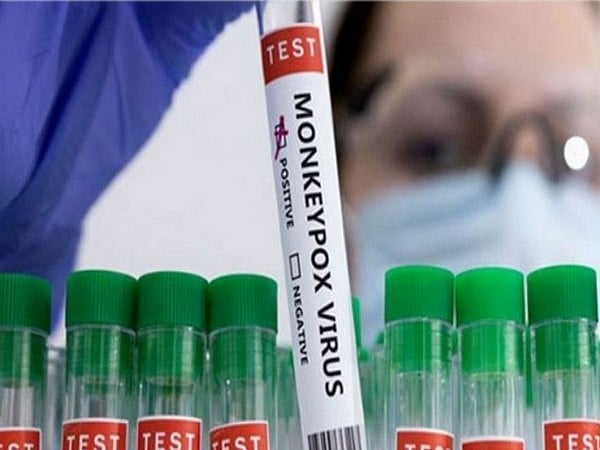 Kerala to release Mpox prevention guidelines after man tests positive ...