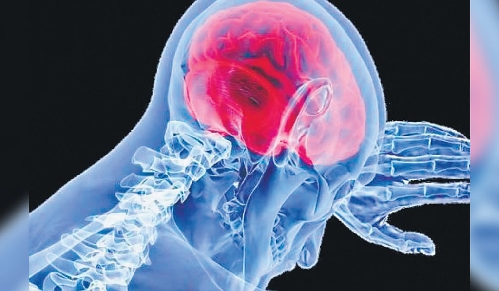 WHO launches first-ever guidelines on meningitis diagnosis to ensure ...