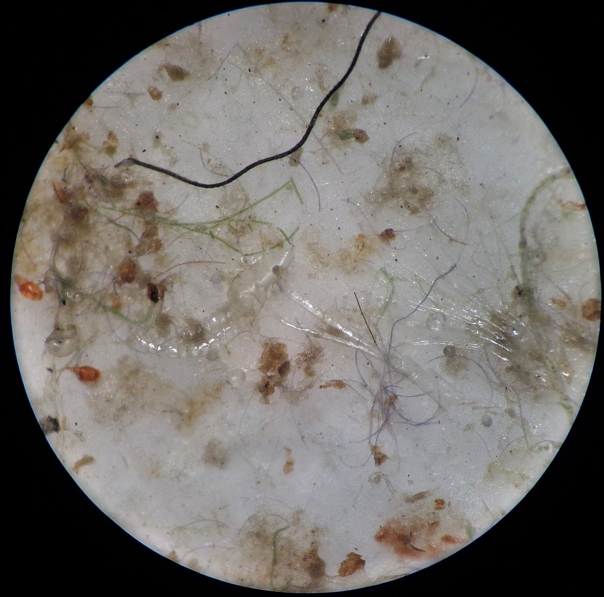 Human testicles contain microplastics and nanoplastics: Study