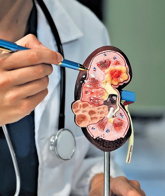 Kidney cancer: Precision medicine may bring transformational outcomes