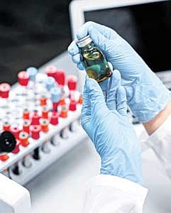 Gene therapy can revolutionise sickle cell treatment