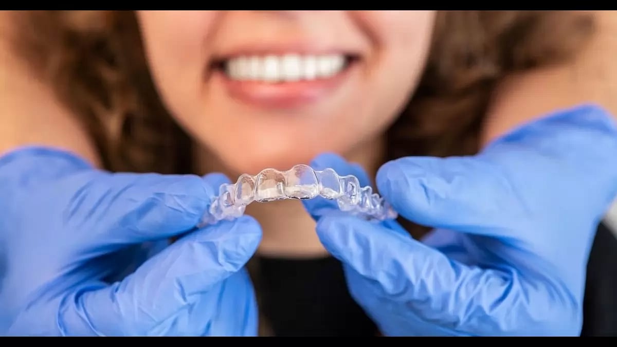 Byte Aligners Reviews: Cost, Results, And Discounts