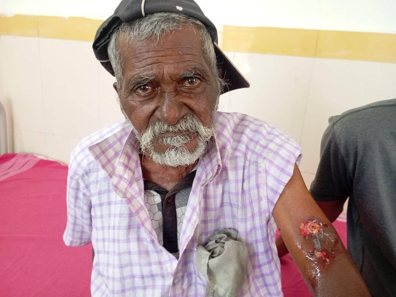 Rabid Dog Attack: ಬೀದರ್: 12 ಜನರಿಗೆ ಕಡಿದ ಹುಚ್ಚು ನಾಯಿ