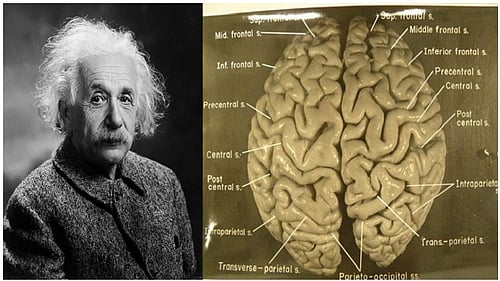 einstein brain was theft. because of he was genious. Doctors said we ...