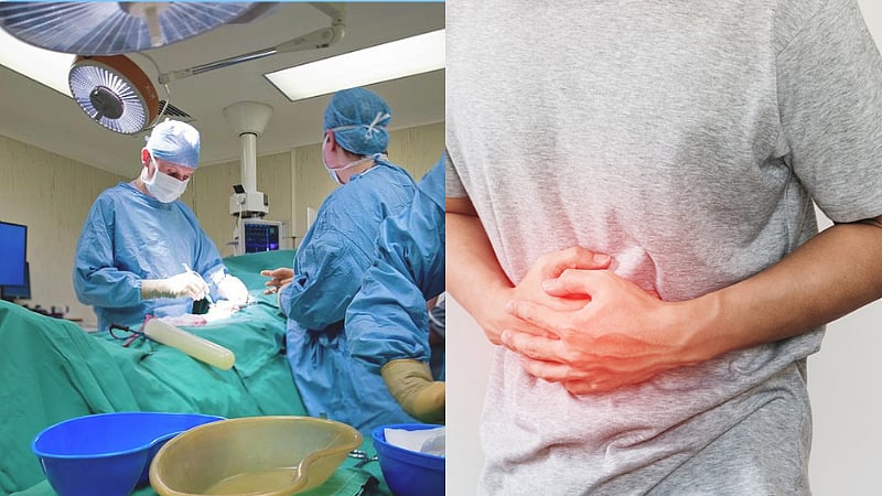 ஹெர்னியா அறுவை சிகிச்சைக்கு சென்ற ஆண் ஒருவருக்கு வயிற்றில் கருப்பை ...