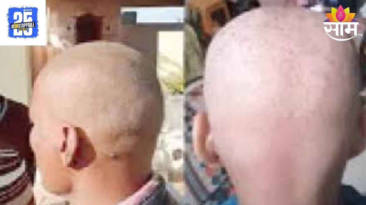 Buldhana : बुलढाण्यातील केस गळतीचे कारण अजूनही गुलदस्त्यात ...