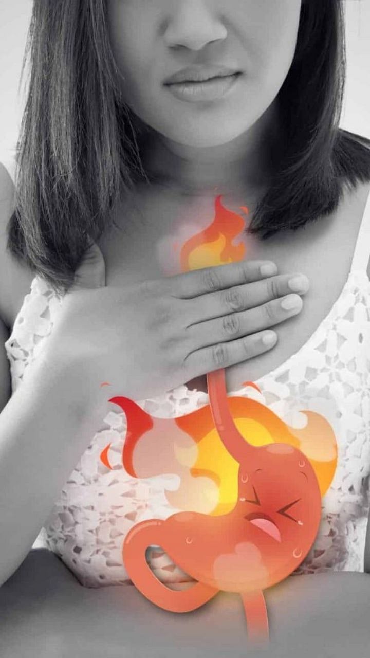 Acidity Problem | अ‍ॅसिडिटी होण्याची कारण काय? उपाय पाहा - Acidity Problem What causes acidity ...