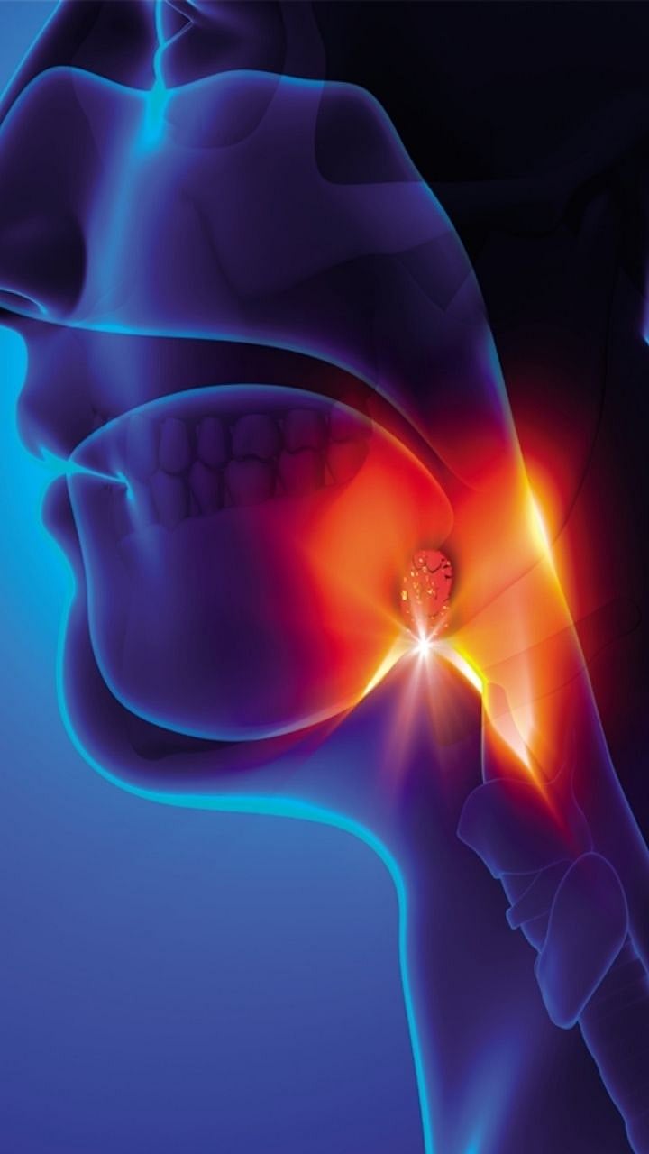 Tonsilsने त्रस्त आहात हे घरगुती उपाय करा, लगेच मिळेल आराम - Try these ...