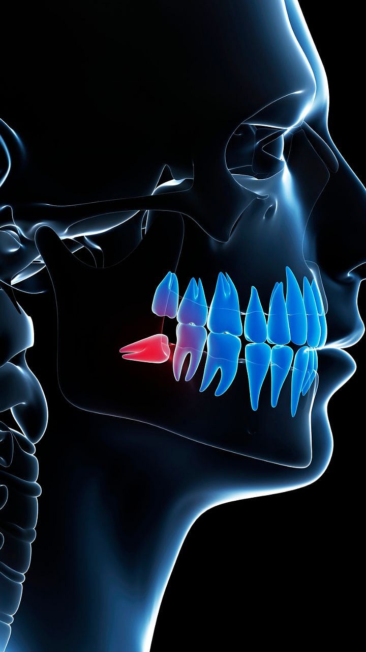 Dental Health: अक्कल दाढ आली की अक्कल येते, असं का म्हणतात?