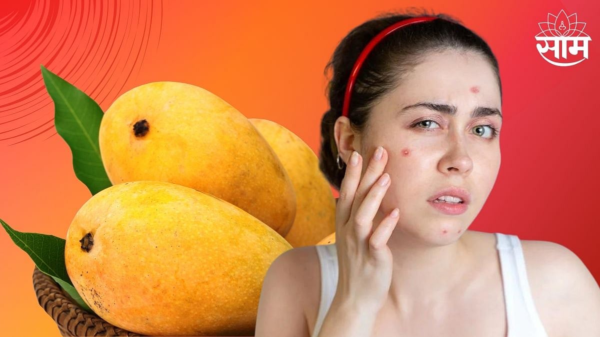 Simple Tricks For Pimple: आंबा खाल्ल्याने तुमच्याही चेहऱ्यावर पिंपल्स ...